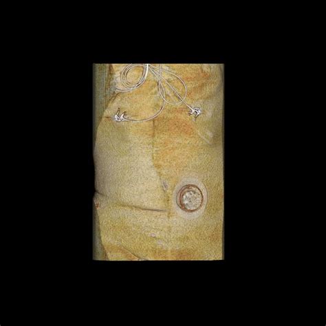 Stanford 3d And Quantitative Imaging Laboratory On Linkedin Medicalimaging Diagnosis Technology