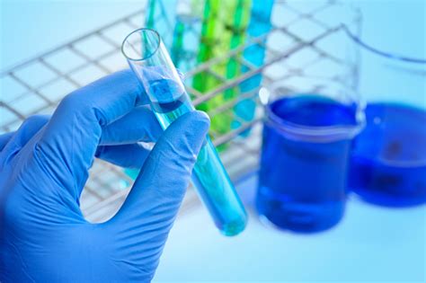 코로나 바이러스 검역의 개념 메르스코브 새로운 코로나 바이러스 N바이러스 테스트는 플라스틱 장갑에 분석가 손의 실험실 테스트 튜브에 스톱 메르스코브 개념에 대한 스톡 사진