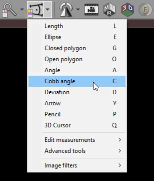Radiant Cobb Angle Radiant Dicom Viewer
