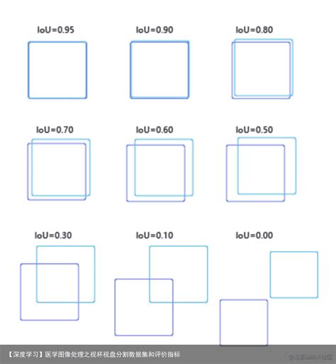 【深度学习】医学图像处理之视杯视盘分割数据集和评价指标 云恒制造