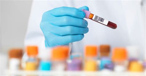 Normal Cholesterol High HDL Levels May Not Protect The Heart