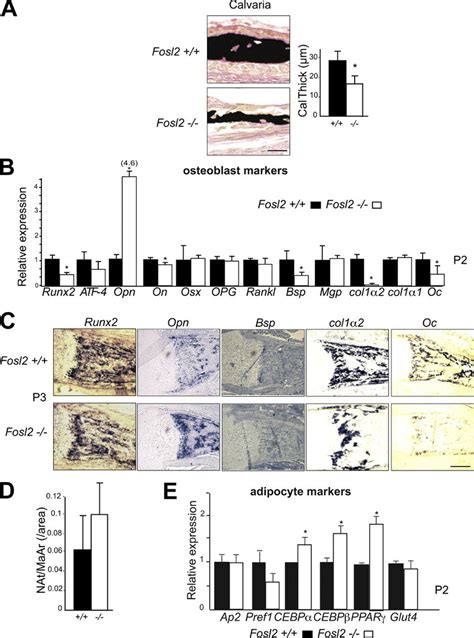 Fosl2 Ko Pups Exhibit An Osteopenic Phenotype A Von Kossa Staining