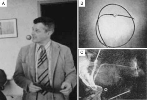 Four Decades The History Of ERCP Abdominal Key