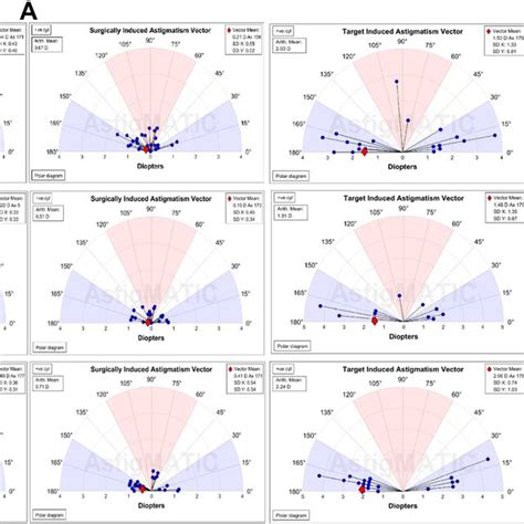 Preoperative And Postoperative Values Of Iop Nct Iop Gat Iopg And Download Scientific