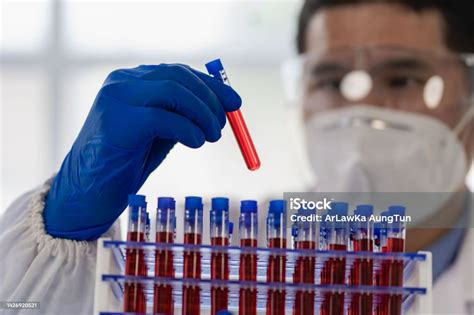 혈액 검사 튜브 한 남성 과학자가 실험실에서 혈액 검사관을 검사하고 있습니다 혈액 샘플 다른 환자와의 Dna 검사 라벨에 대한