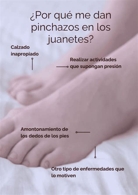 ¿qué Hay Que Saber Sobre Los Juanetes Aiudo Servicios