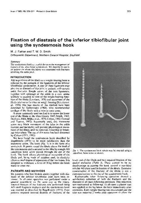 Pdf Fixation Of Diastasis Of The Inferior Tibiofibular Joint Using