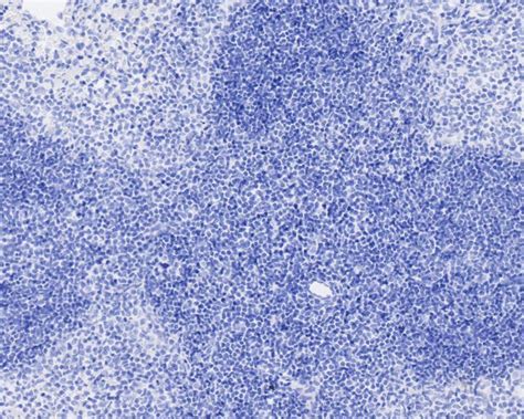 Digoxigenin Recombinant Monoclonal Antibody Psh04 39 Ma5 56506