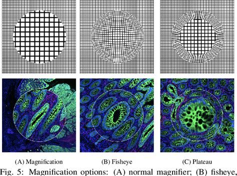 Scope2screen Focus Context Techniques For Pathology Tumor Assessment In Multivariate Image Data