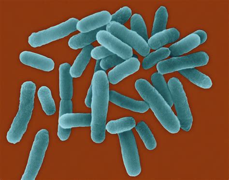 Legionella Pneumophila Photograph By Dennis Kunkel Microscopy Science Photo Library