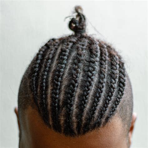 The Dihydrotestosterone Dht Hormone And Its Role In Hair Loss