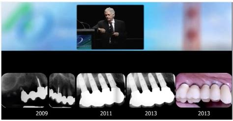 American Academy Of Periodontology Honors Dr Oded Bahat With Master