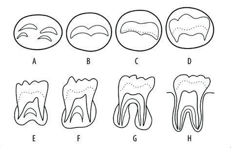 Tooth Mineralization Stages According To Demirjian Et Al 1973 Stage Download Scientific