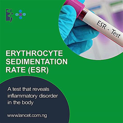 Esr Erythrocyte Sedimentation Rate Testing Levels More 43 Off