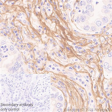 Anti Periostin Antibody Rm1074 Ab315104 Abcam