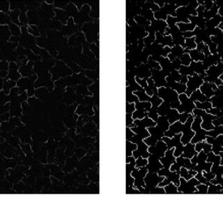 A Enhanced Contrast By Using The Clahe Method B Gaussian Filter R