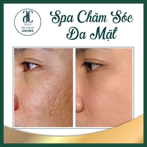 TOP 5 Spa Chăm Sóc Da Mặt Tại TPHCM Chất Lượng Uy Tín