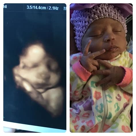 Firstimpressions Ultrasound On Linkedin 4dultrasound