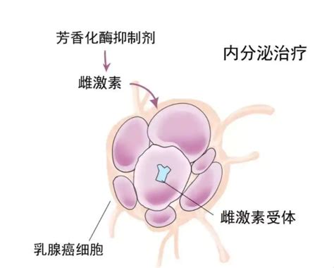 乳腺癌为什么要做内分泌治疗？哪些患者需要做 知乎