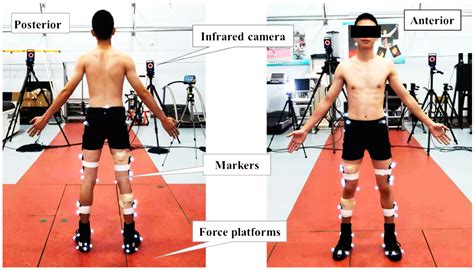 Patellofemoral Syndrome Exercises Pdf Spanish Fermin Royer