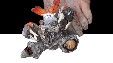 Extremely Long Toenails Abnormal Growth Of Black Mud 👣 Professional