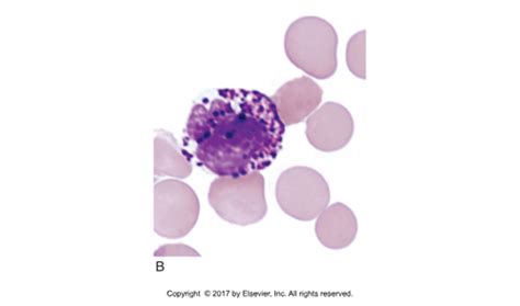 Hematology Final Exam Media Lab Questions Part 1 Flashcards Quizlet