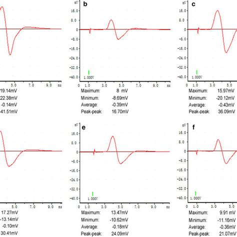 Representative Traces Of Compound Action Potential Cap Of Download Scientific Diagram