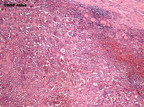 Hsp Atlas Histopathology Atlas Endocrine