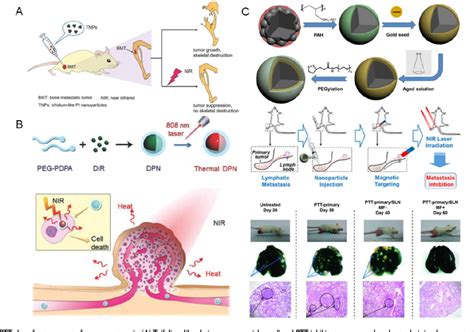 Figure 1 From Current Approaches Of Photothermal Therapy In Treating