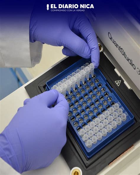 Laboratorio De Biología Molecular En Managua El Diario Nica