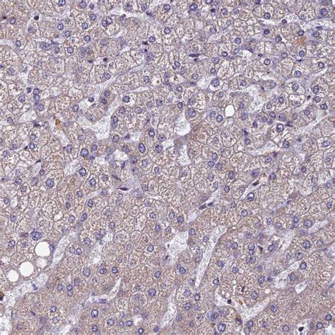 Rabbit Polyclonal Anti Edar Antibody Buy For Research Highly
