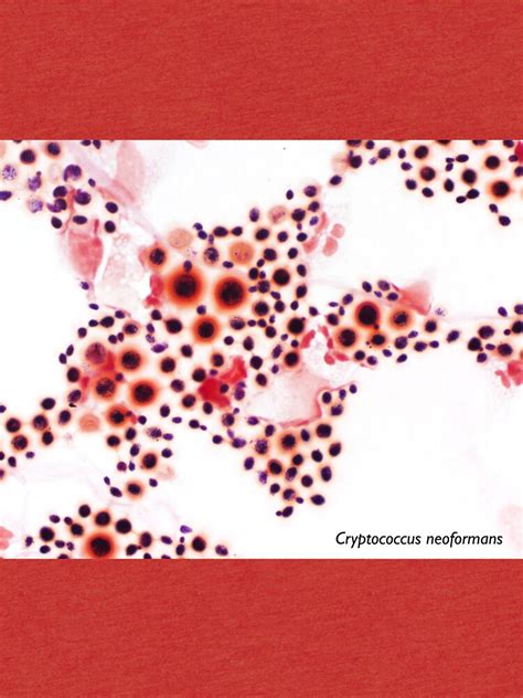 Cryptococcus Neoformans T Shirt By Bpritt Redbubble