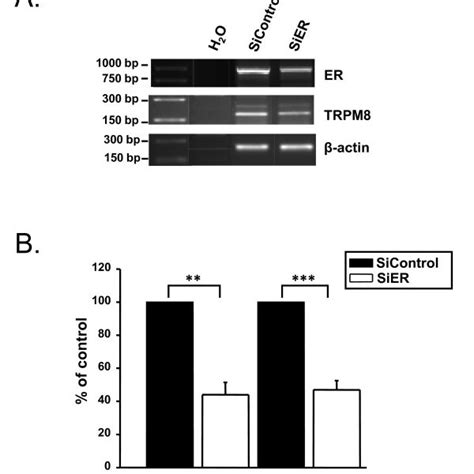 Over Expression Of Trpm8 In Breast Adenocarcinomas Download