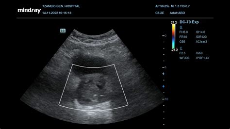Ultrasound Journal 14 Basic And Advanced Ultrasonographic Techniques