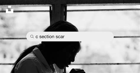 C Section Scar Pictures Download Free Images On Unsplash