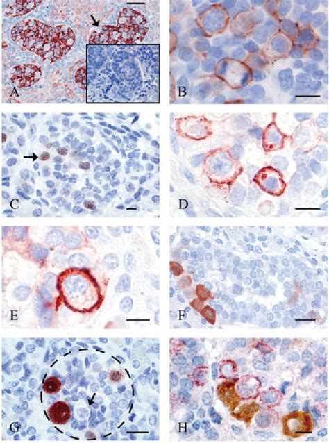 Figure 1 From Spatial Expression Of Germ Cell Markers During Maturation