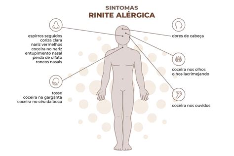 Rinite Alérgica Causas e sintomas Dra Brianna Nicoletti