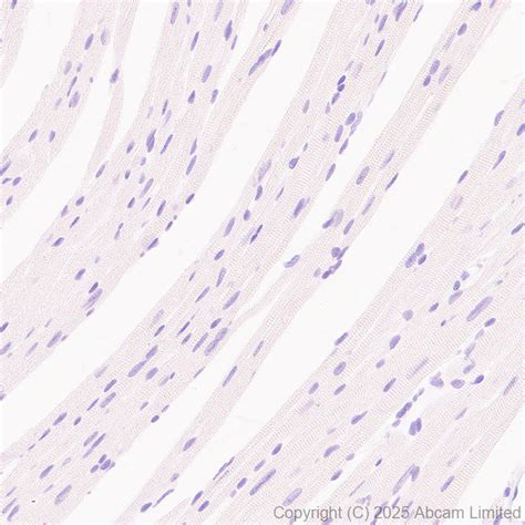 Anti Myod1 Antibody Epr29627 738 Ab323377 Abcam