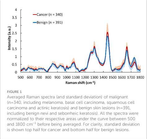 Figure 1 From Improving Skin Cancer Detection By Raman Spectroscopy Using Convolutional Neural