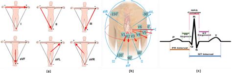 Pre Processing Techniques And Artificial Intelligence Algorithms For Electrocardiogram Ecg