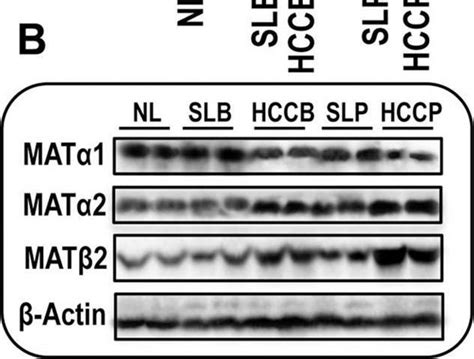 Mat2b Antibodies Antibody Search Engine Citeab