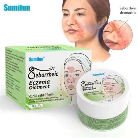 Obat Gatal Eczema Cream 30g Seborrheic Dermatitis Obat Psoriasisanti