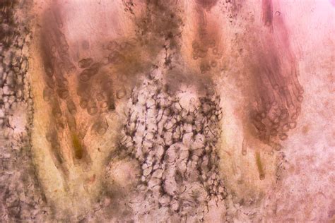 Protoxylem Vessels Near Stem Of Carrot 200x 21f Eosin Y Stain