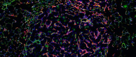 Solutions Withinsight Algorithm And Views Mit Department Of Biology