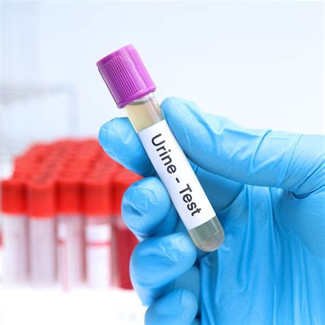 Std 8 Panel Test Dubai Lab Tests