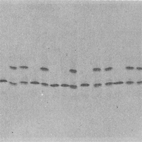 Typical Gel Pattern Of Sheep Hemoglobin Separated By Thin Layer Download Scientific Diagram
