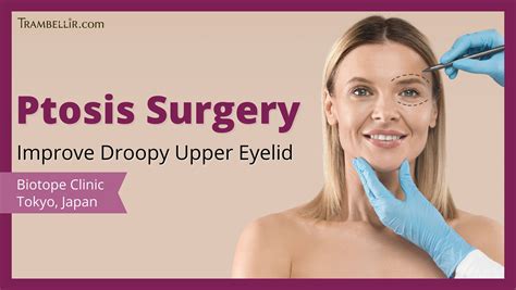 Ptosis Surgery Improve Droopy Upper Eyelid Trambellir
