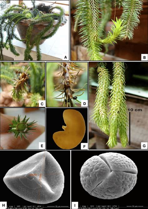 Morphological Structures Of Sporophytic Body In Huperzia Squarrosa G