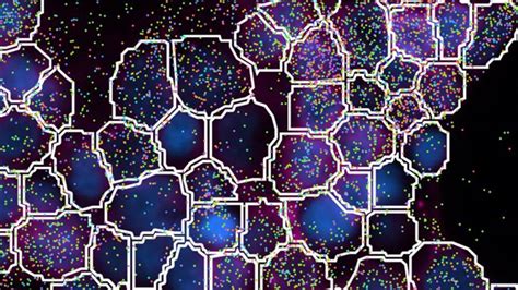 Spatialtranscriptomics Bioinformatics Cancerresearch Machinelearning Kristen Wingert