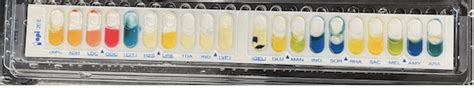 Identify Api Strip Rmicrobiology